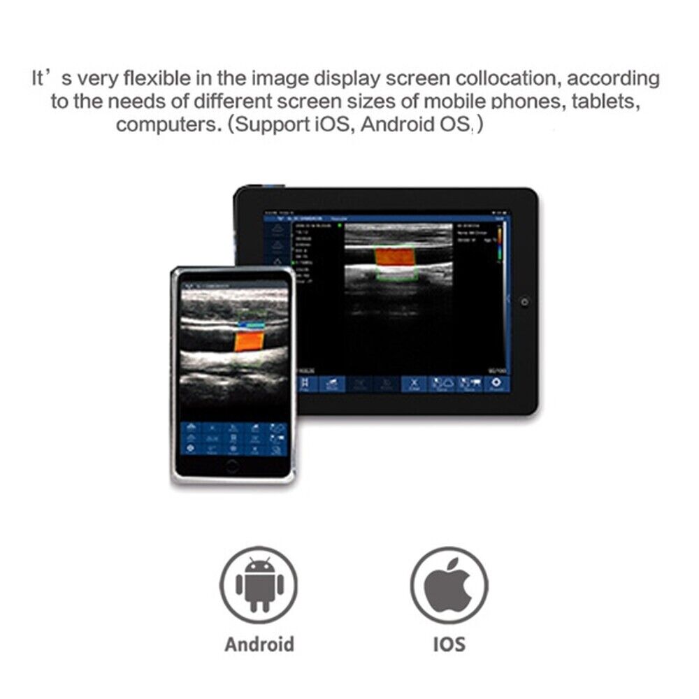 CMS1600B-VET handheld dual-probe color Doppler ultrasound diagnostic s ...