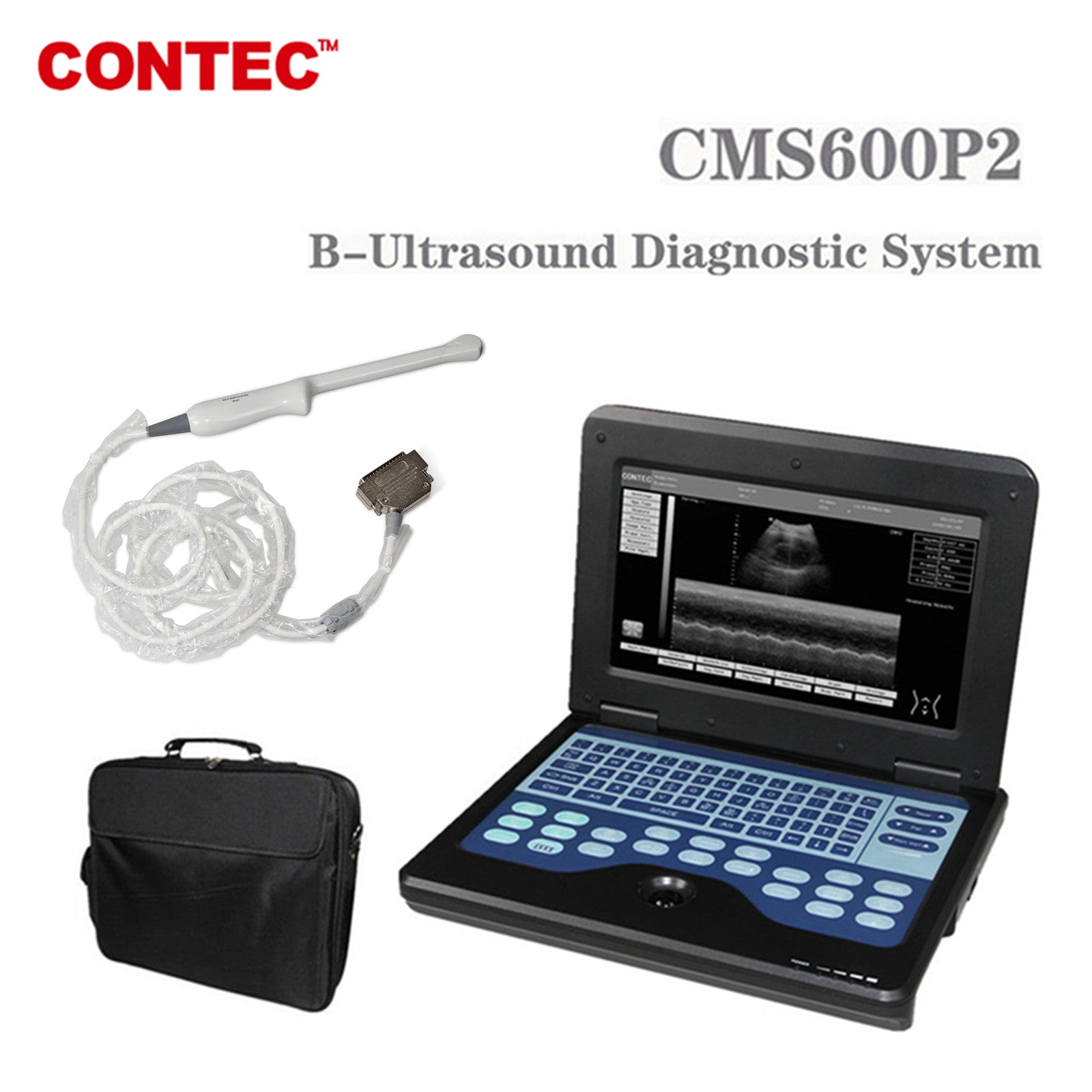 CONTEC Portable Laptop Machine Digital Ultrasound Scanner,6.5 MHz endo