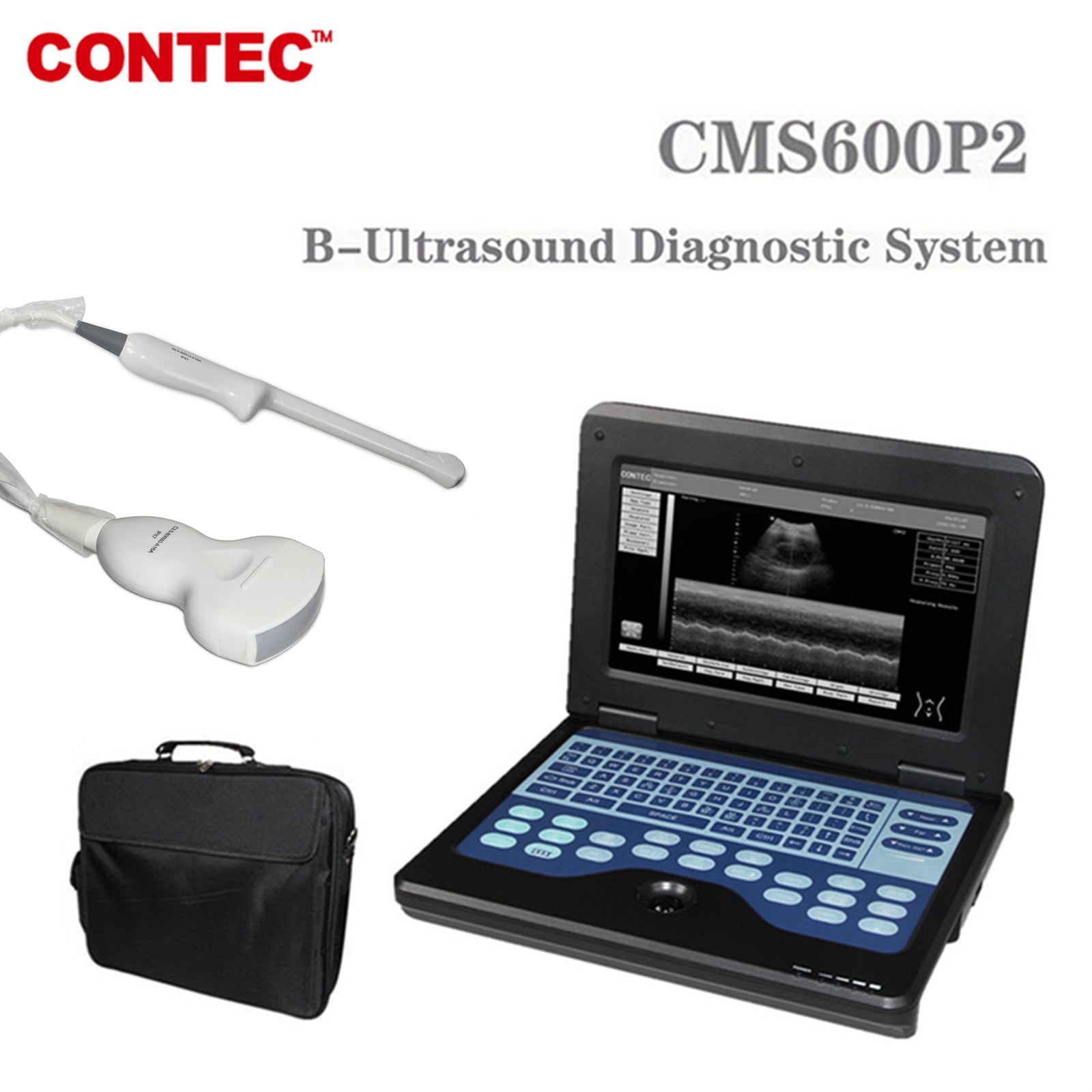 CONTEC Portable Laptop Machine Digital Ultrasound Scanner,2Probes Conv