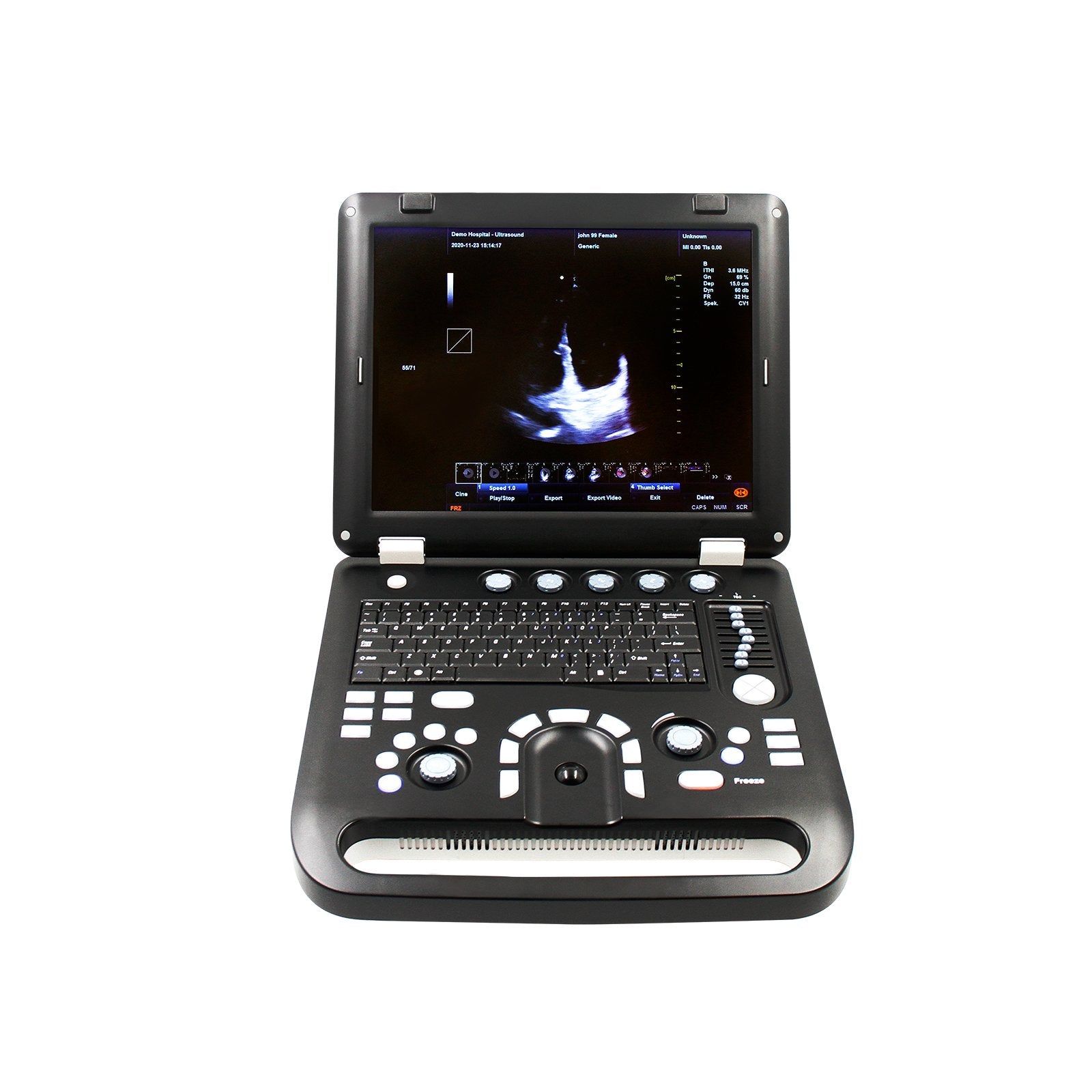 Veterinary use Color Doppler CMS1700C-VET Portable Ultrasound Scanner ...