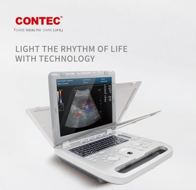 Ultrasound Scanner & Color Doppler – CONTEC